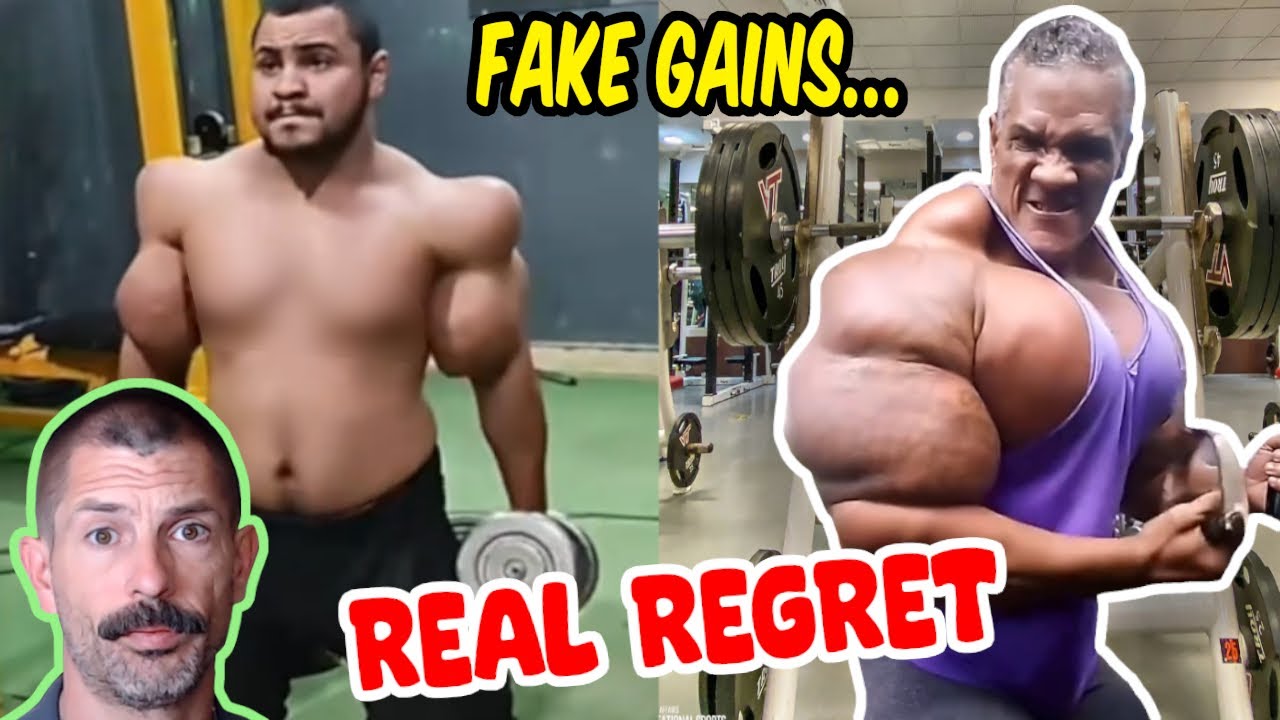 Unbelievable Synthol Fails - Fake Muscle Madness - YouTube