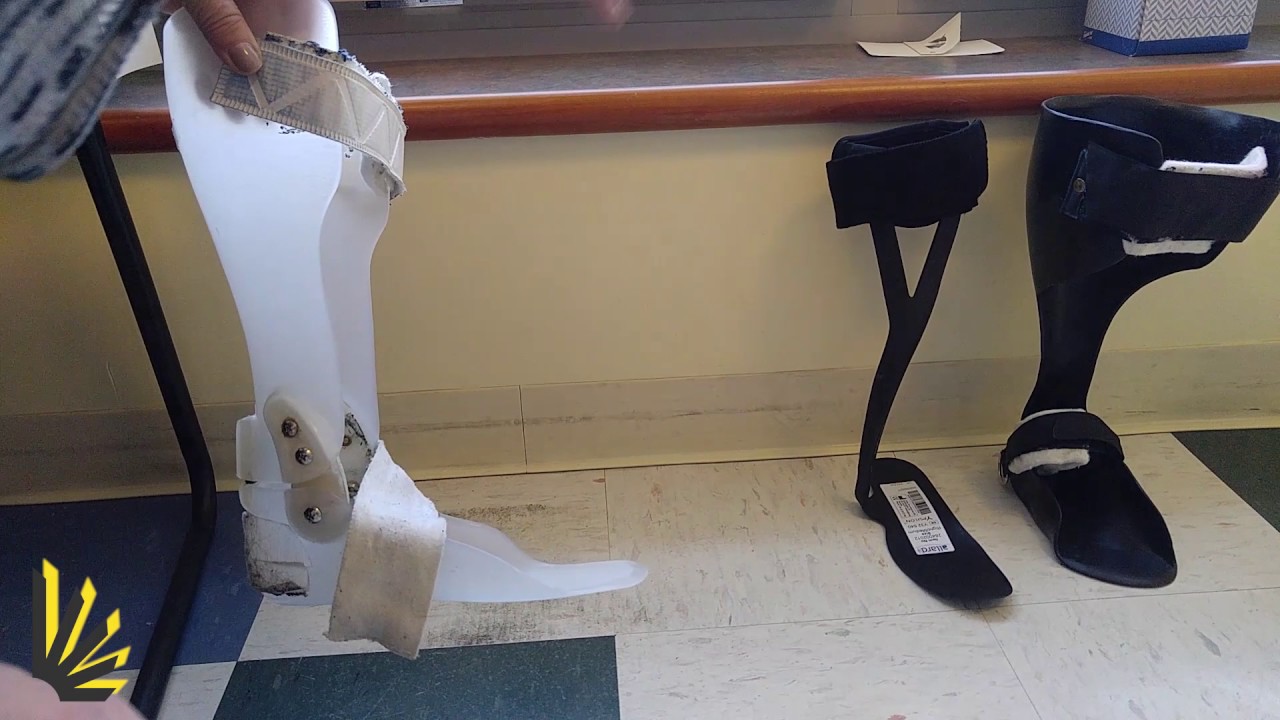 Sally compares The Step-Smart Brace for Drop Foot to other AFO's - YouTube