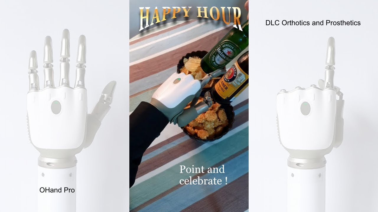 AI Prosthetic Hand with 27 Grip Patterns | Point - YouTube