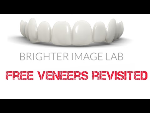 Free veneers revisited brighter image labs Bil - YouTube