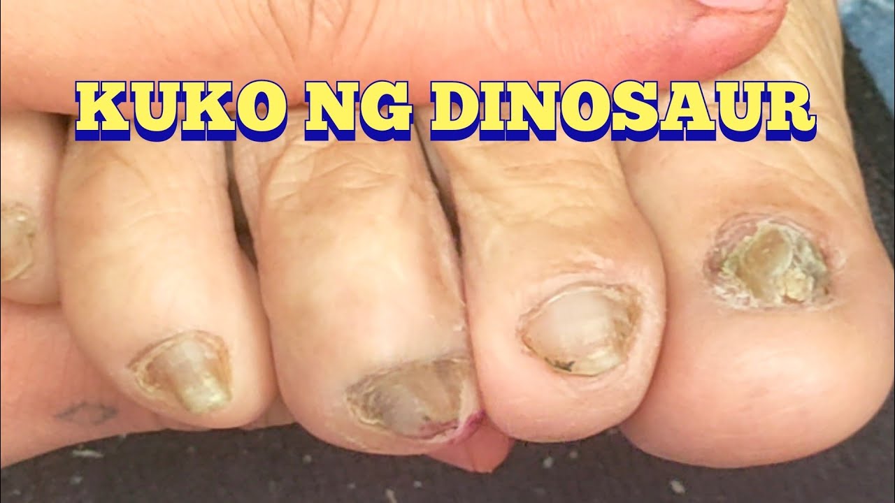 PART1 KUKO NG DINOSAUR - YouTube