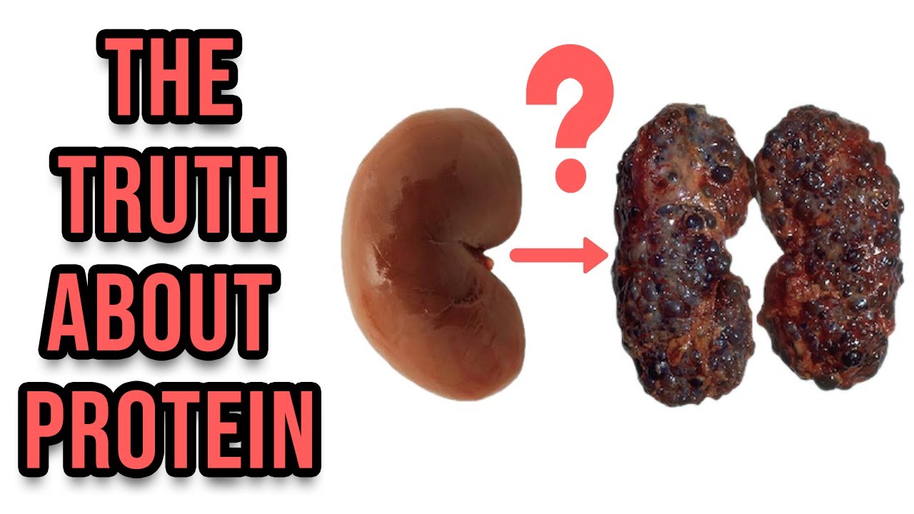 The Truth About Protein: How Much Do You Need? Is It Toxic? - YouTube