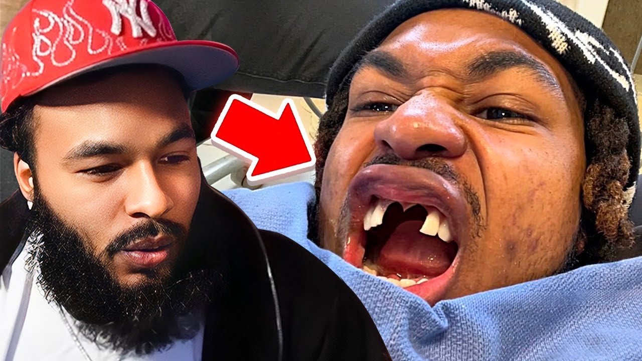 ClarenceNyc Reacts To DDG TAKES OFF HIS VENEERS.. REAL TEETH EXPOSED ...