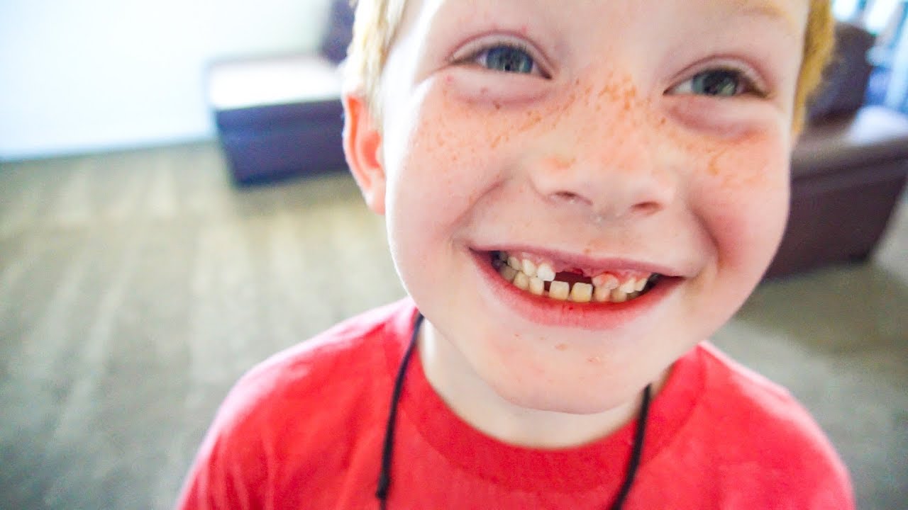 OUCH! Did My Tooth Just Come Out? - YouTube