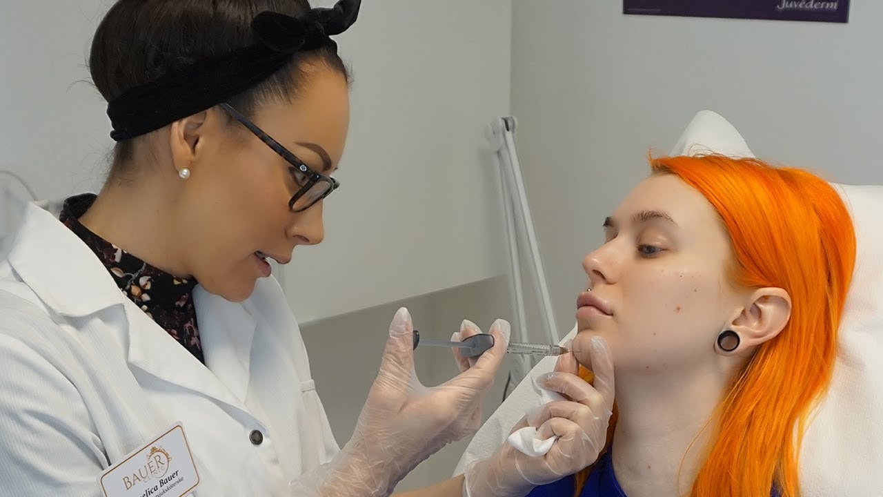 Trying out Fillers | VLOG - YouTube