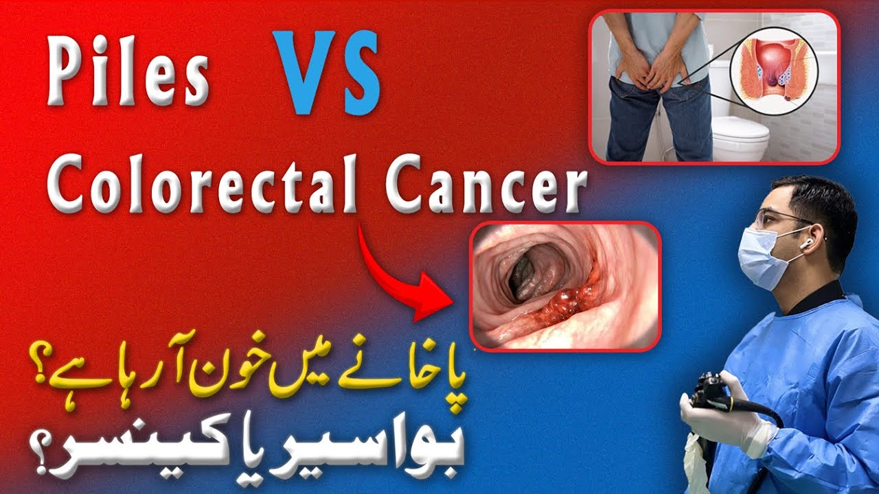 Pakhane Me Blood Aane Ki Wajah | Piles Vs Colorectal Cancer ...
