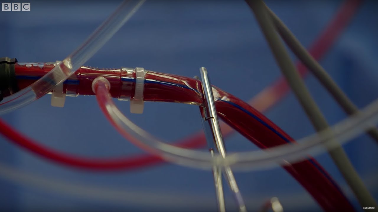 Draining ALL The Blood From A Live Patient! | Earth Science - YouTube