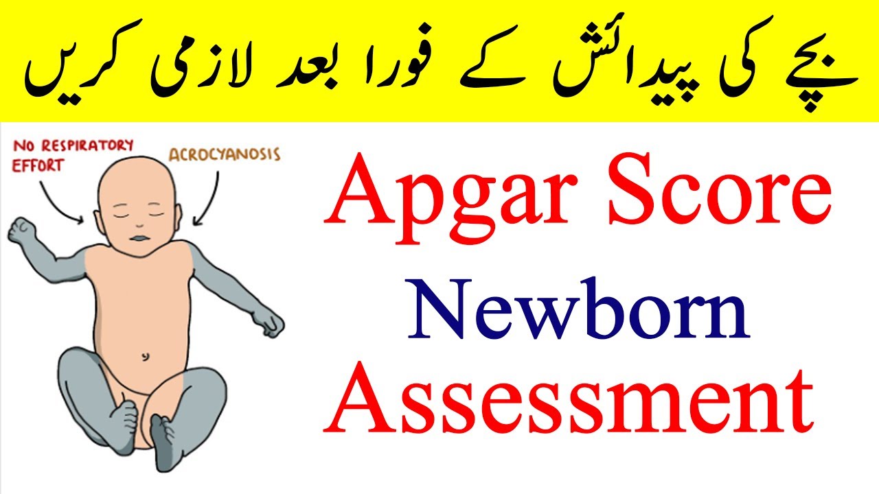 Apgar Score Newborn Baby - How To Calculate APGAR Score In Urdu ...