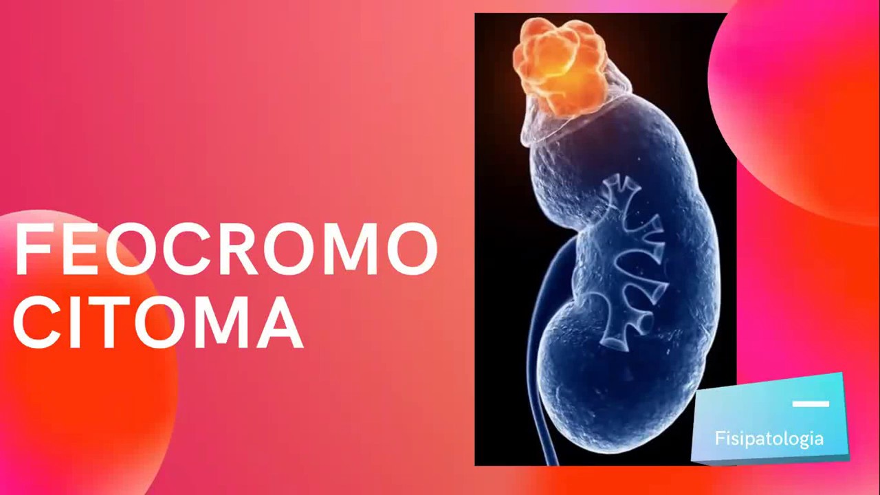FEOCROMOCITOMA - YouTube