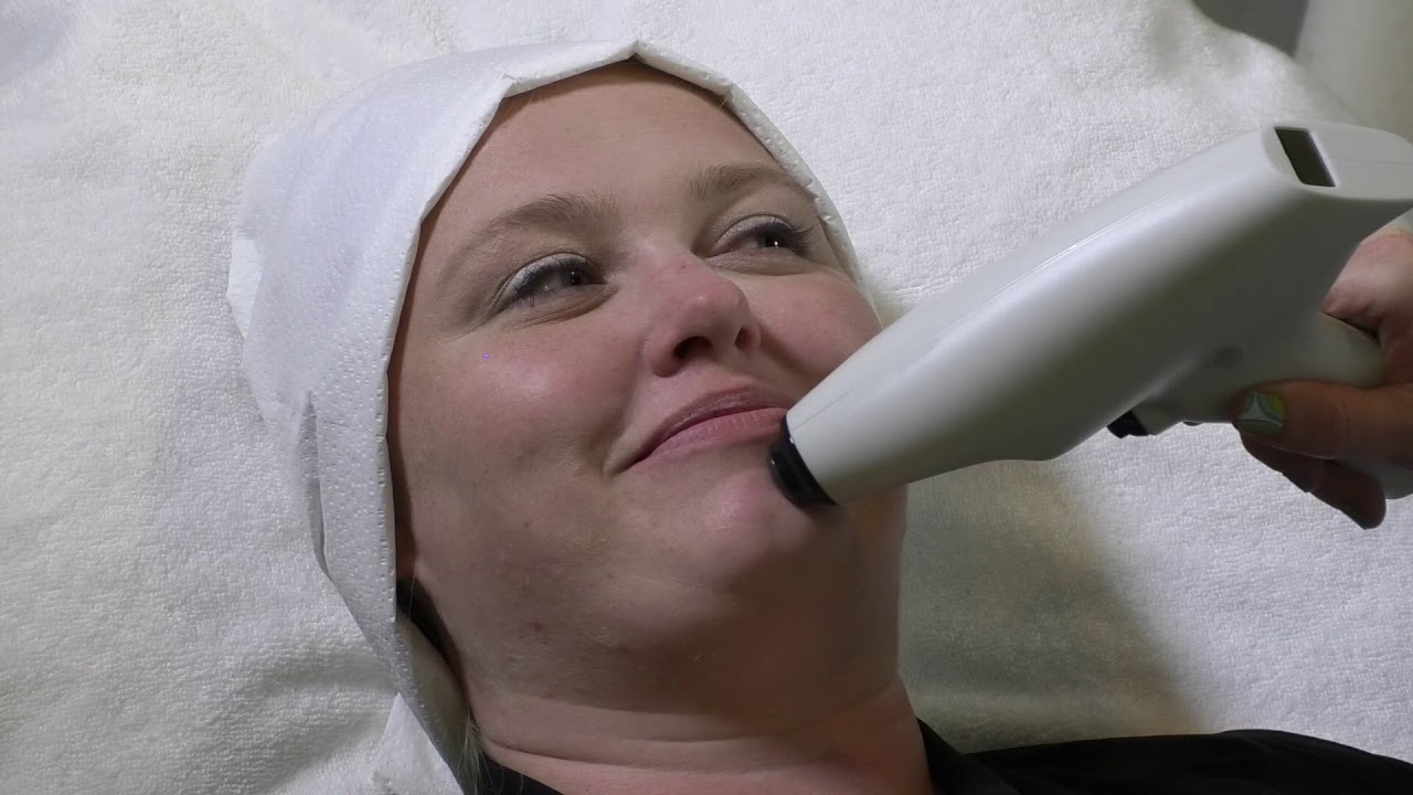 VShape Ultra | JuVa Shape Body Sculpting Overview | NampaObgyn - YouTube