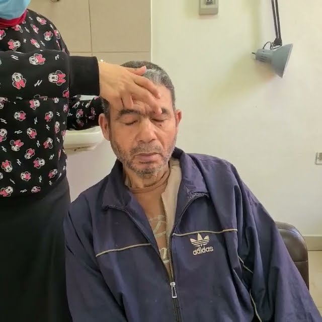 Neurological signs: Pathological reflex Glabellar reflex - YouTube