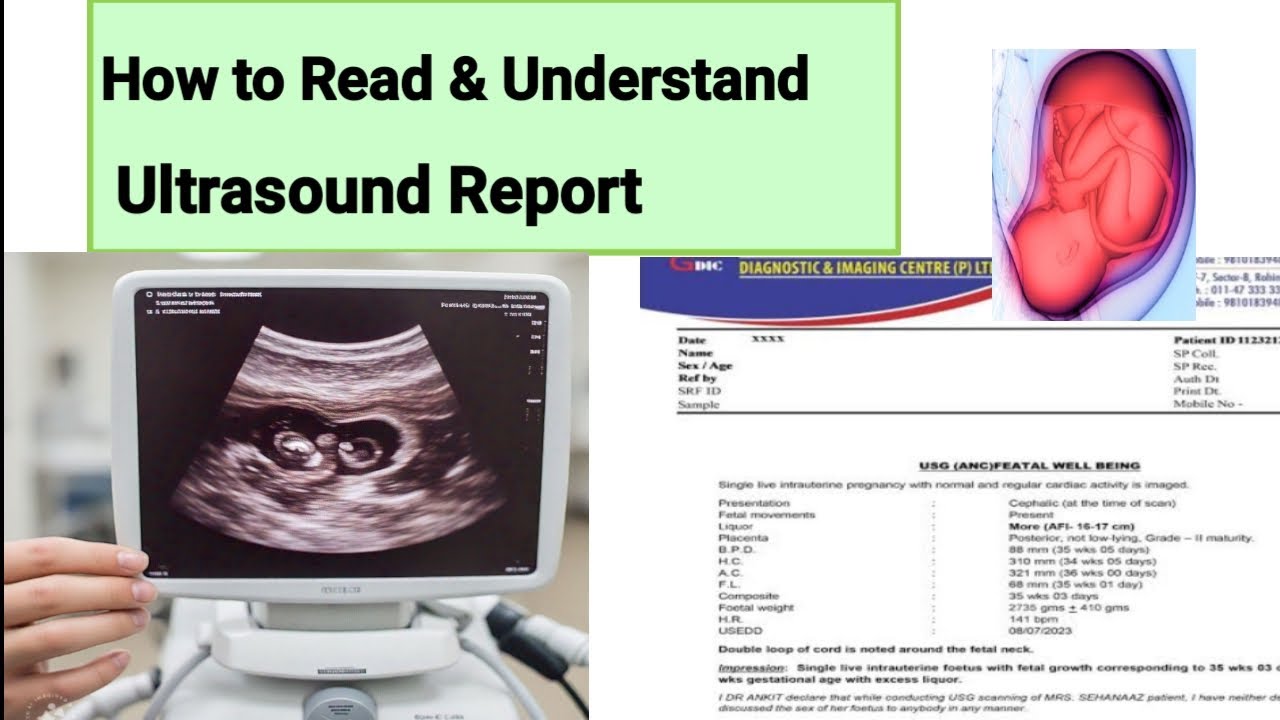 Ultrasound Unveiled: A Simple Guide to Reading Scans