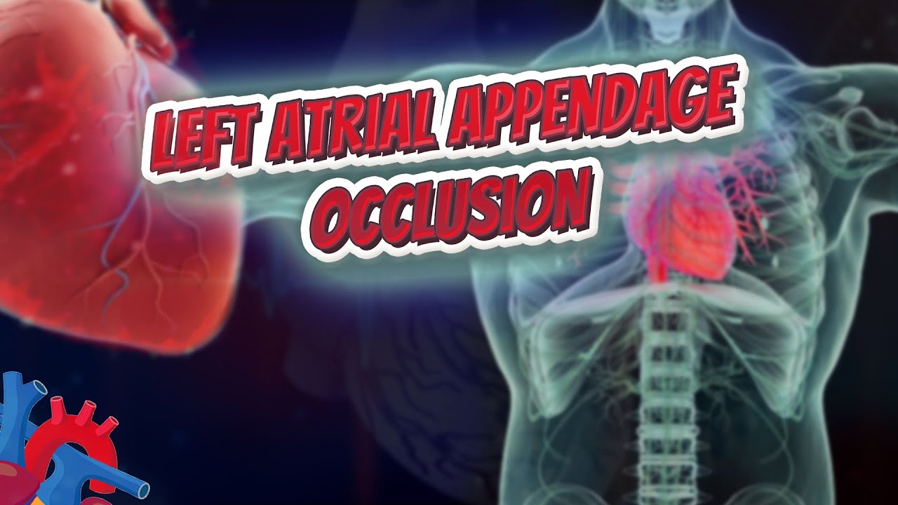Left atrial appendage occlusion - Human Heart and Cardiology ️ ️ ️🔊 ...