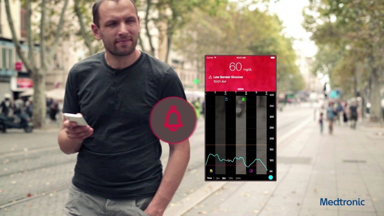 Medtronic - Guardian Connect Continuous Glucose Monitoring system (CGM ...