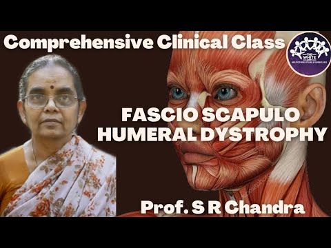 Fascio Scapulo Humeral Dystrophy Case Presentation - YouTube
