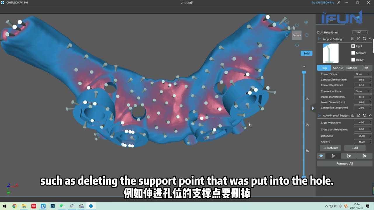 How To Print Ortho Surgical Guide with 3D Printer In Right Way - YouTube