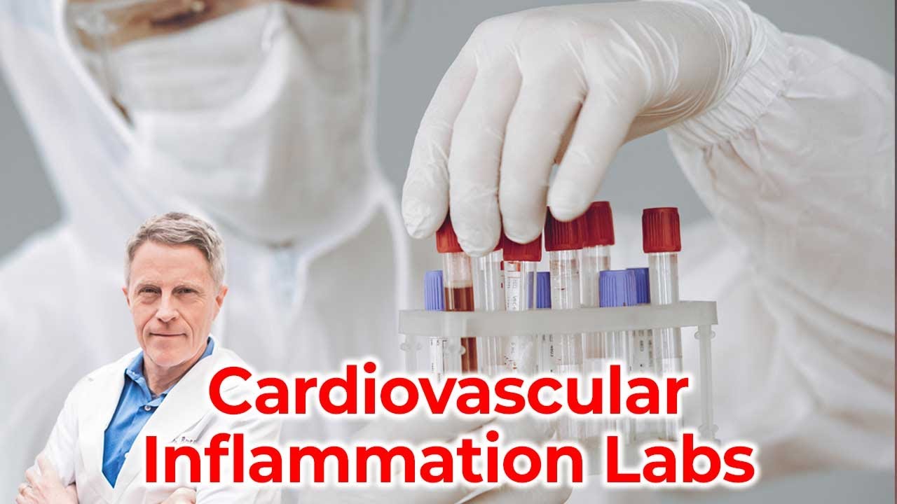 CV Inflammation Labs - YouTube