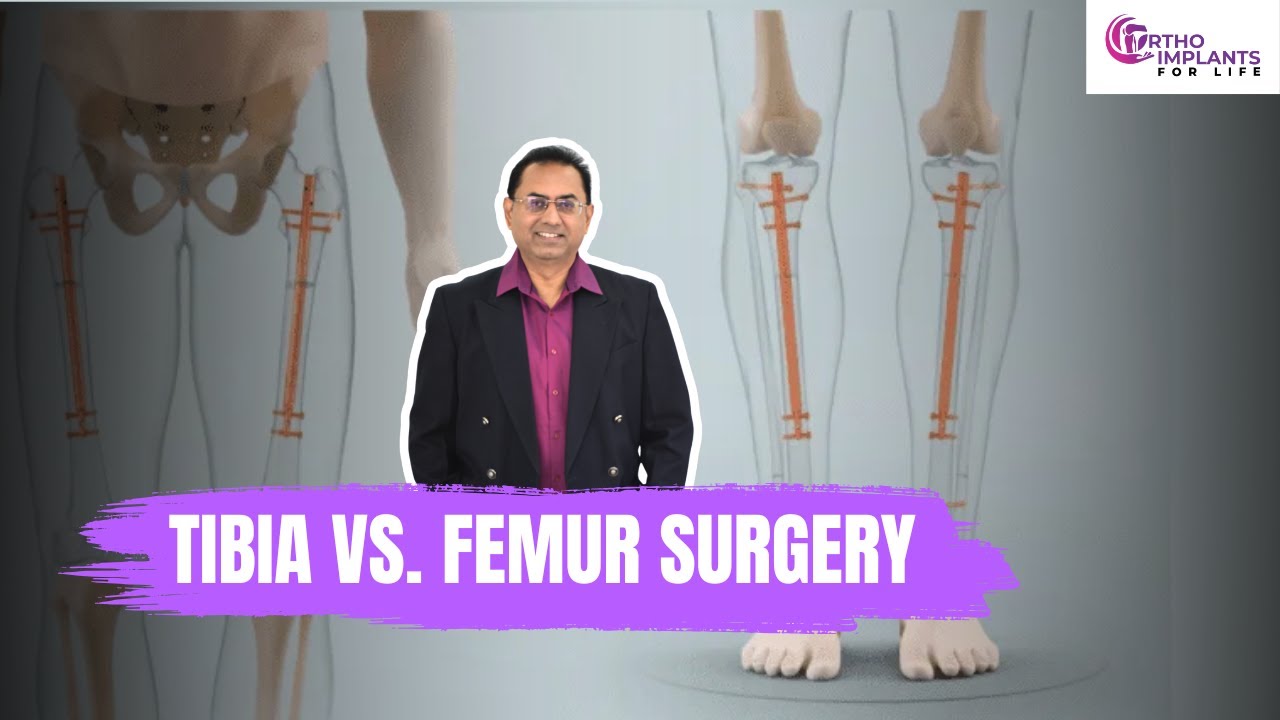 Tibia vs. Femur Surgery: What’s the REAL Difference? - YouTube