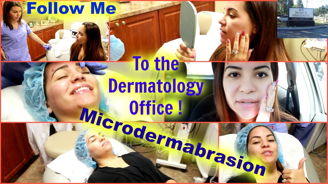 Microdermabrasion Demonstration !! Follow me to the Dermotologist ...