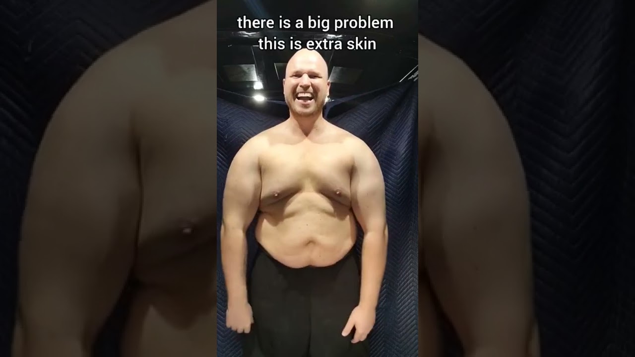 Dmirtry Azovski Weight Loss Transformation 😍 - YouTube