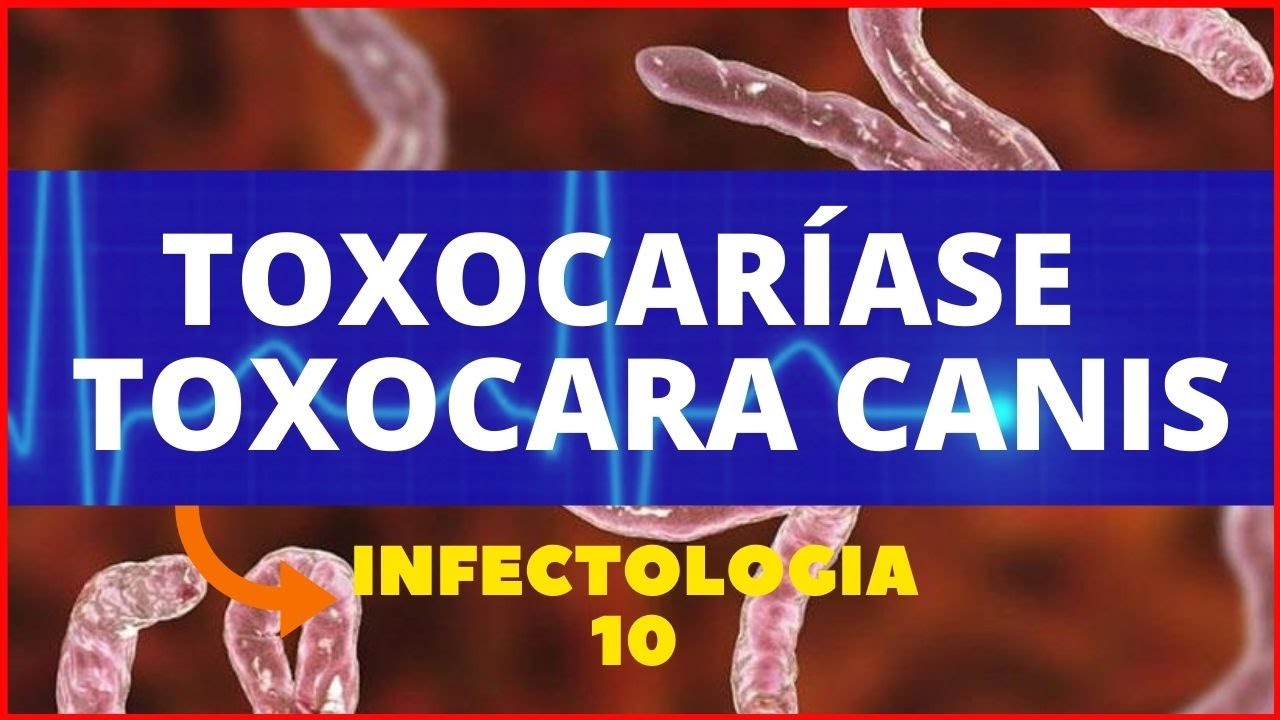 TOXOCARÍASE -TOXOCARA CANIS - PARASITOLOGIA | INFECTOLOGIA - YouTube