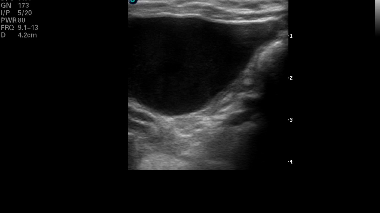 canine cystitis - YouTube