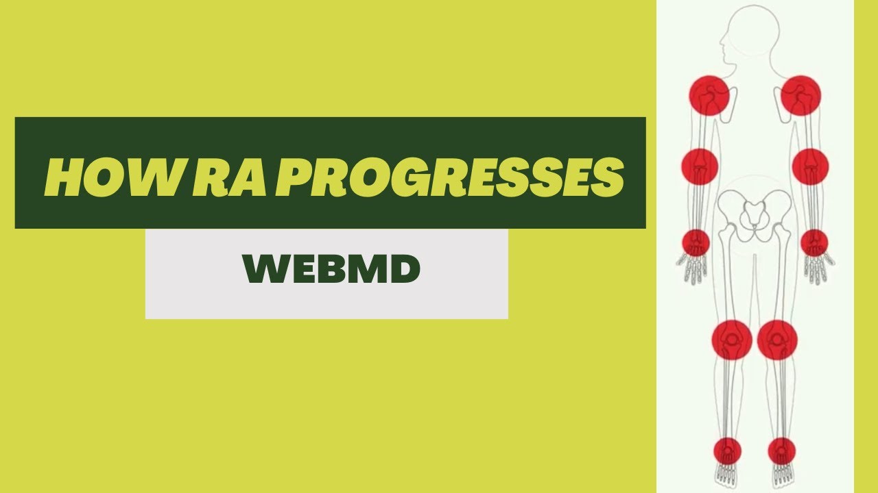 How RA Progresses | 2D Medical Animation | Pixeldust Studios - YouTube