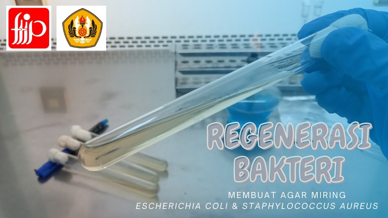 Regenerasi Bakteri/Menumbuhkan Bakteri/Agar Miring/Slant Agar ...