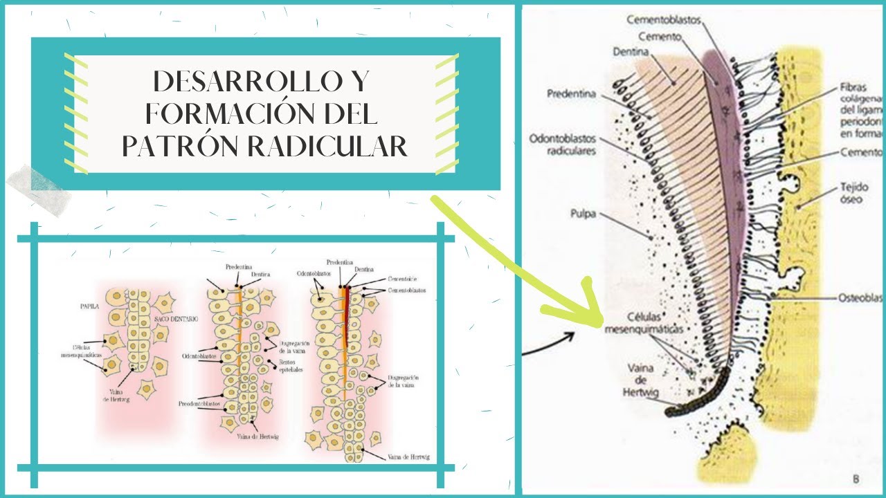 Desarrollo del patrón radicular | Formación de la raíz dental - YouTube