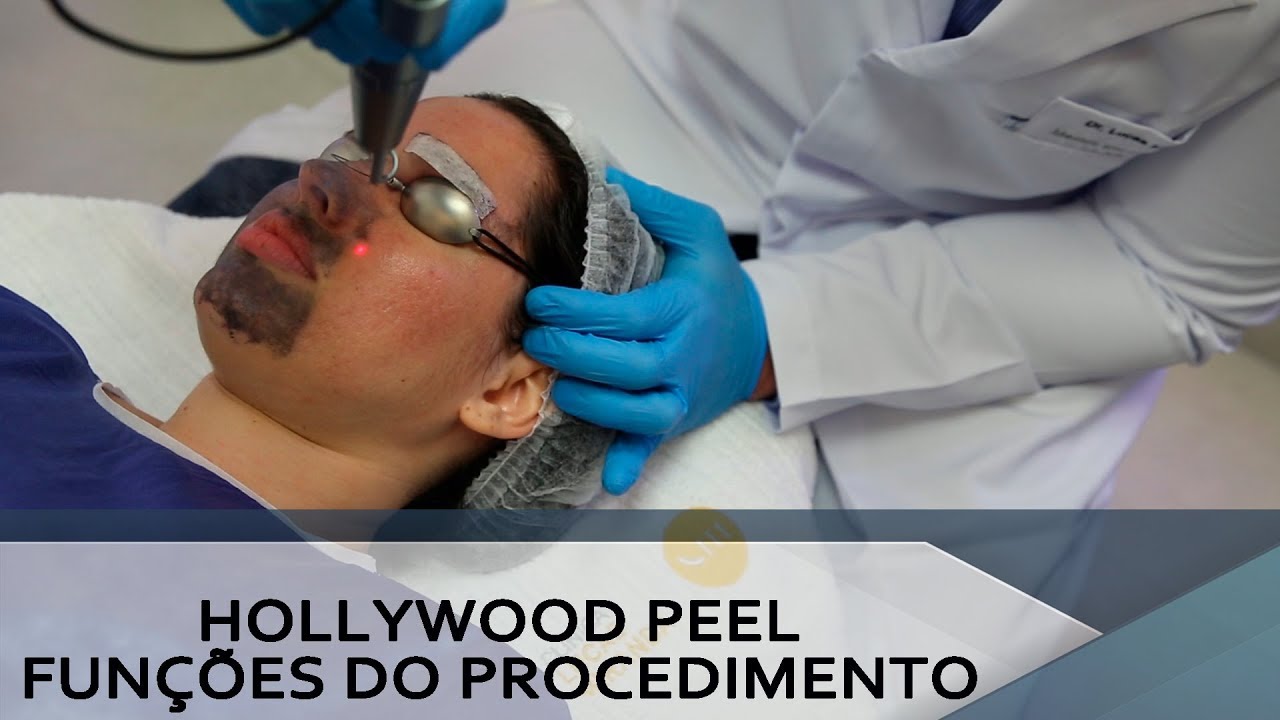 Hollywood Peel - Funções, benefícios, etapas e protocolos do ...