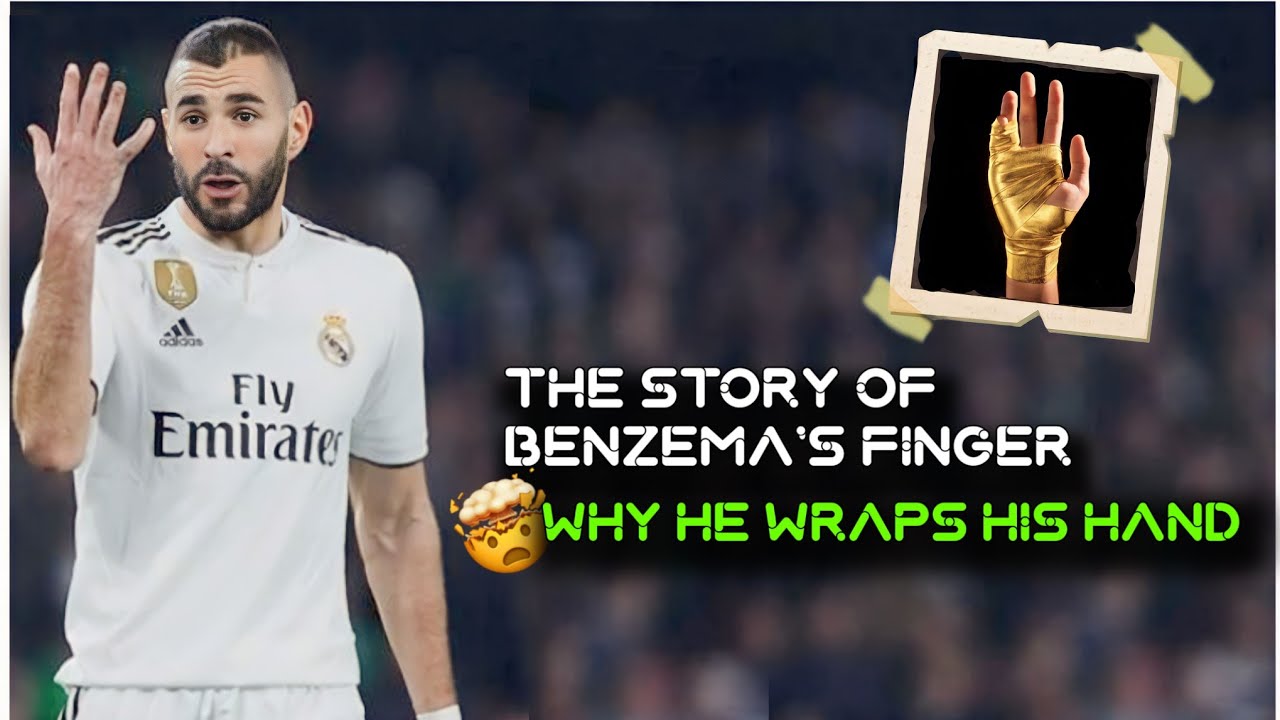 "The secret of Benzema's bandage on his hand: the story that not many ...