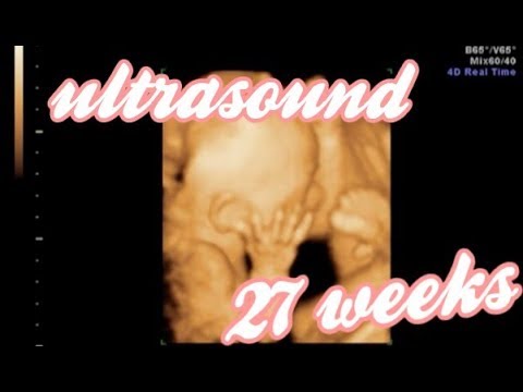 BABY GIRL 3D 4D ULTRASOUND 27 WEEKS PREGNANT - YouTube