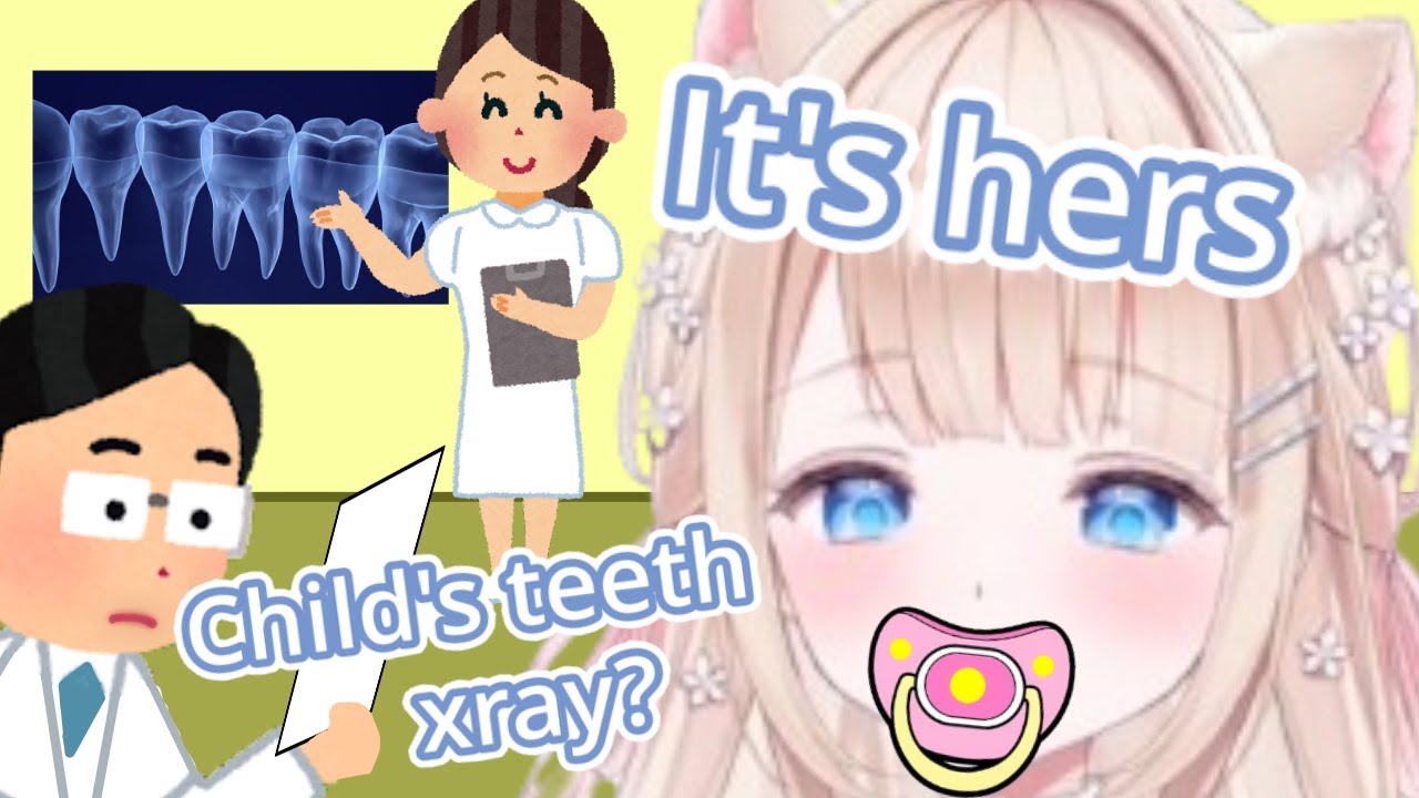 Doctor thought they took the wrong xray because Peo's teeth is too smol ...