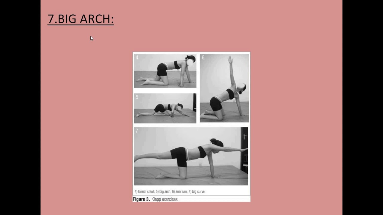 KLAPP EXERCISES PART- 2 📖 Exercise for scoliosis &to correct wrong body ...