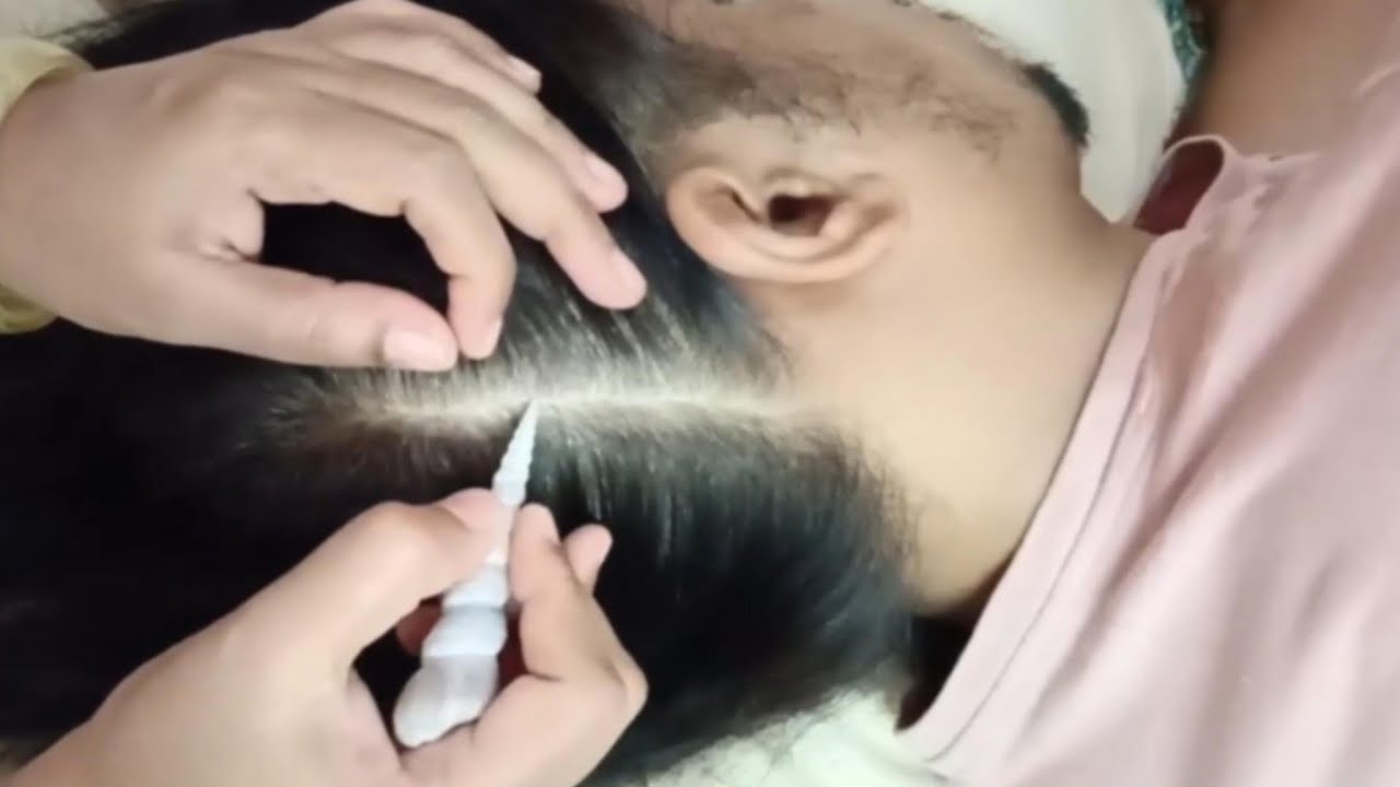ASMR Relaxing Scalp Check On a Real Person - YouTube