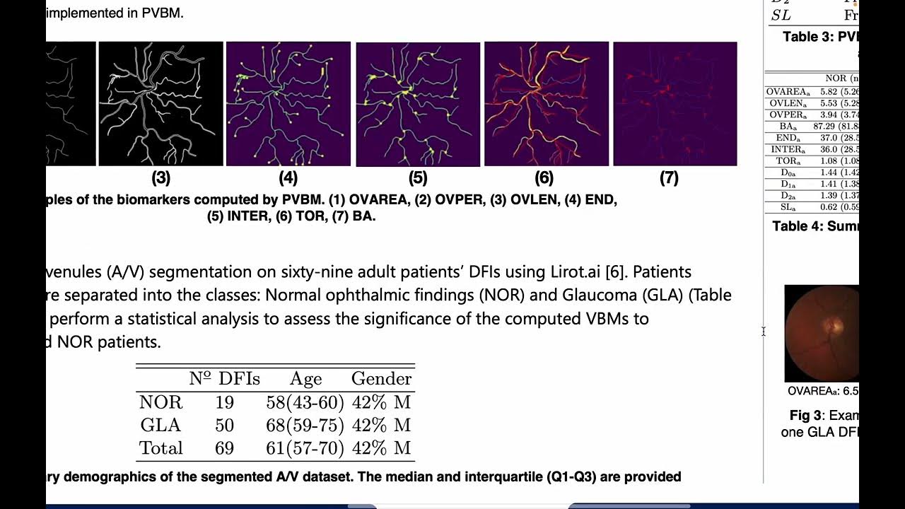 PVBM: A Python Vasculature Biomarker Toolbox Based On Retinal Blood Vessel Segmentation - YouTube