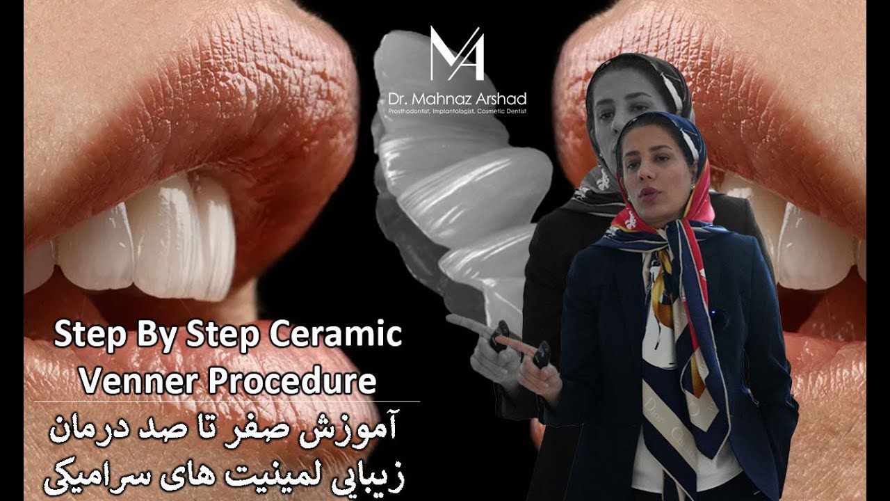 Step by Step Ceramic Veneer Procedure - YouTube