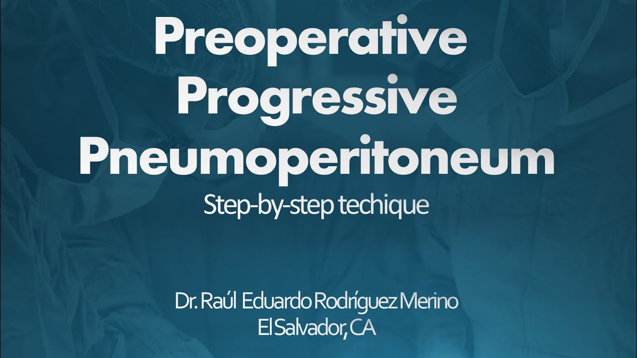 Preoperative Progressive Pneumoperitoneum Step-by-step technique for ...