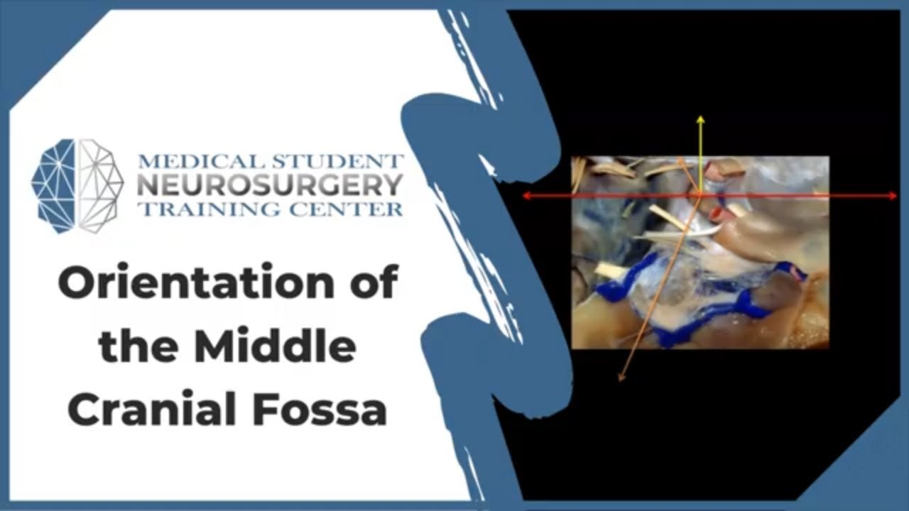 Orientation of the Middle Cranial Fossa - Neurosurgery Training Center ...