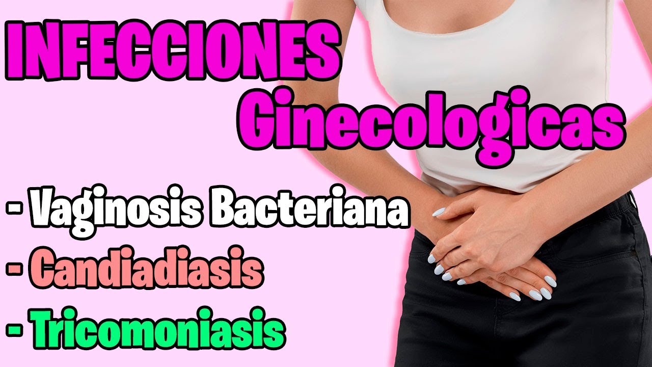 INFECCIONES GINECOLOGICAS: Candidiasis V, Vaginosis bacteriana y ...