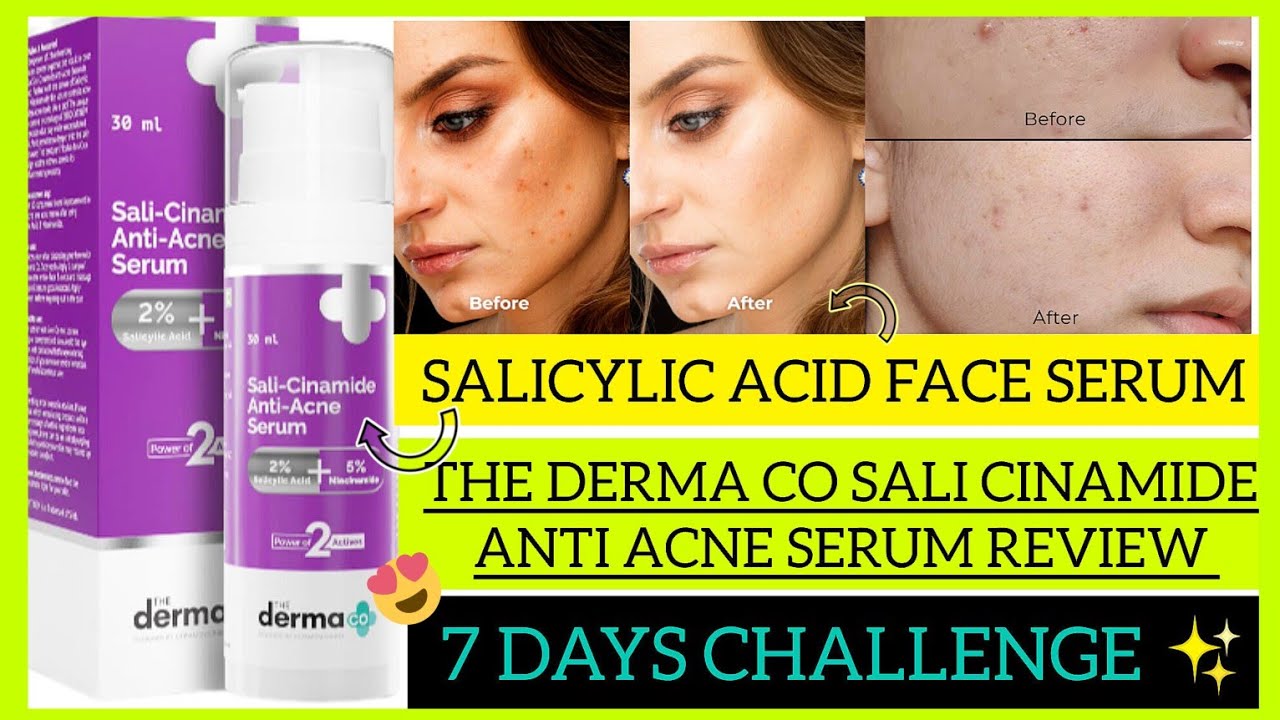 Anti - Acne Serum 😍 Derma Co. Sali - Cinamide Anti Acne Serum Review ...