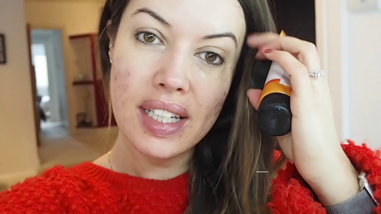 Roaccutane | Month 2 - 40mg | Skin Diary | Third Time Lucky | Super ...