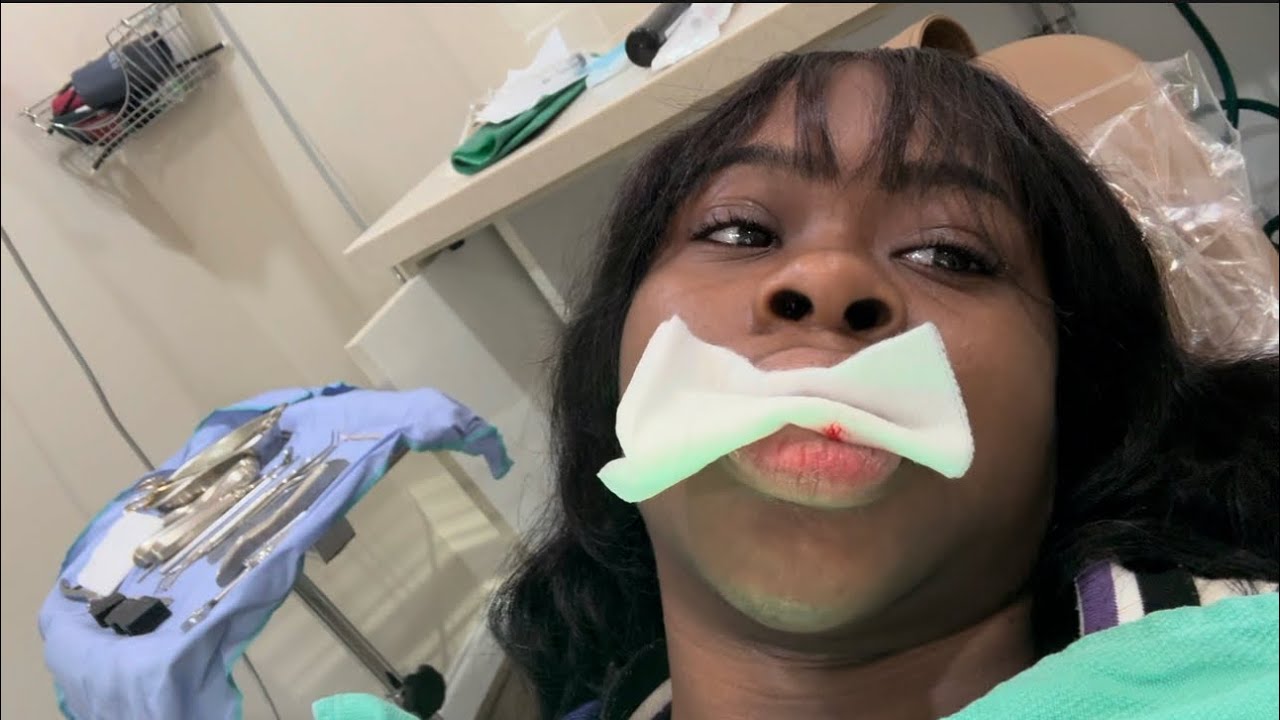THIS IS HOW MY LIP SURGERY WENT … - YouTube