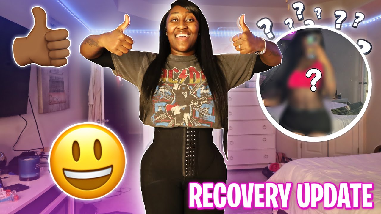BBL+LIPOSUCTION RECOVERY UPDATE!!! - YouTube
