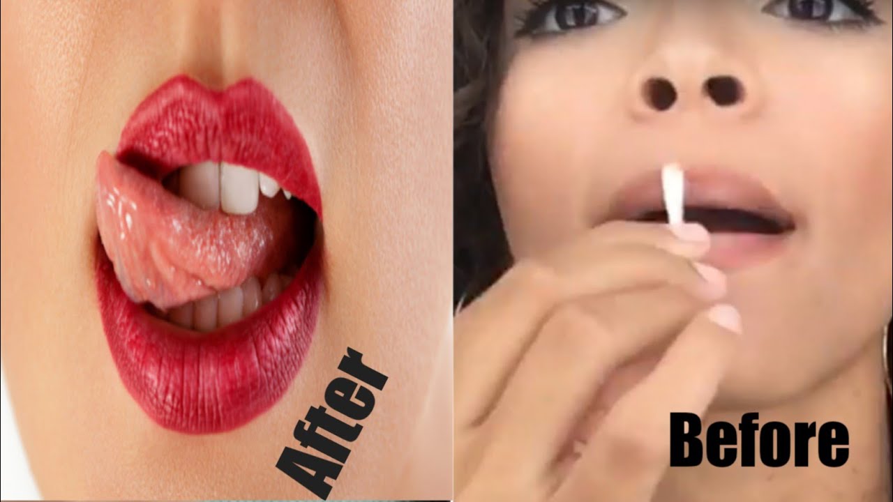 How to skin remove lips#Sugar lip service tinit# remove/💯 - YouTube