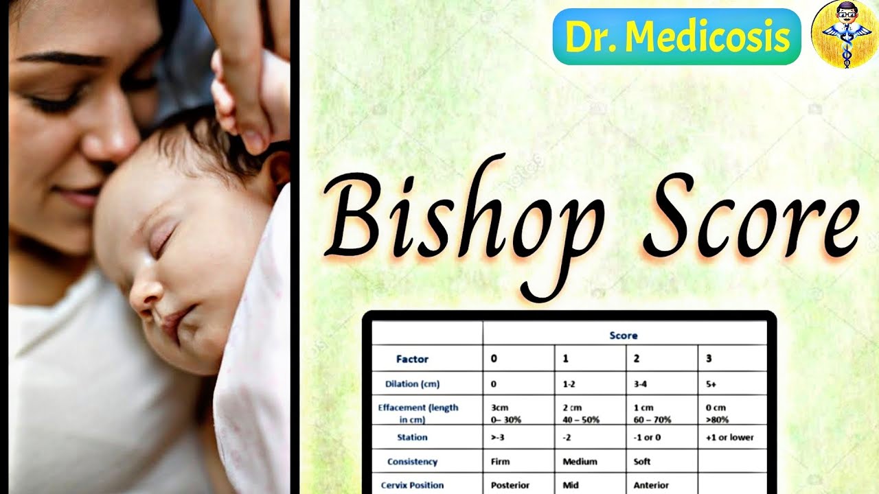 Bishop Score | 5 Criteria | Dr. Medicosis - YouTube