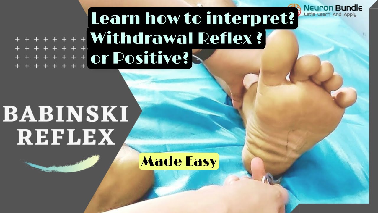 Babinski reflex-detailed assessment #Triplefelxionbabinski # ...
