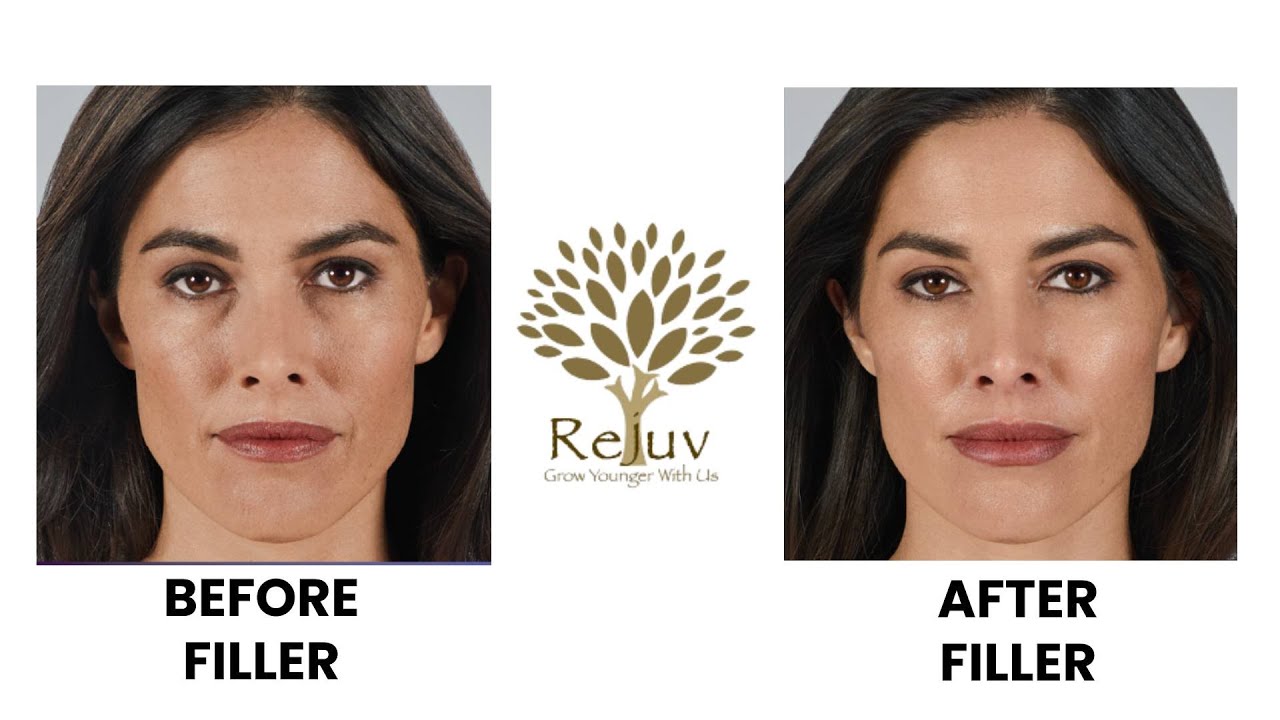 How To Get Rid Of Fine Lines And Wrinkles - YouTube