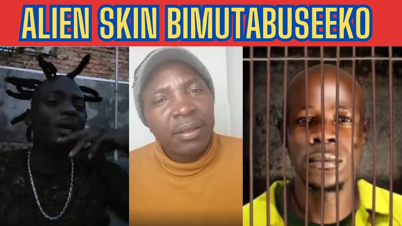 HON NSEREKO Aleese updates on alien skin & julio mukomera e luzira ...
