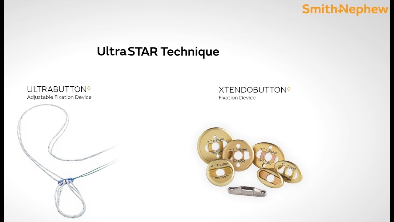 ULTRABUTTON - Button-Button-Technik mit XTENDOBUTTON (UltraSTAR) - YouTube